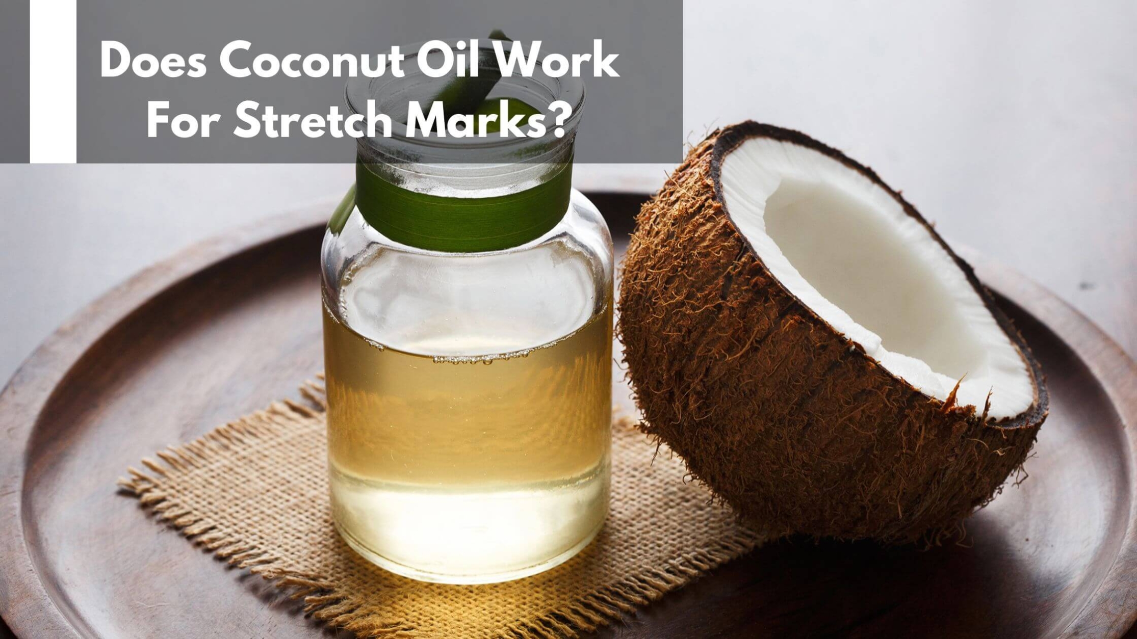 Does Coconut Oil Work For Stretch Marks?
