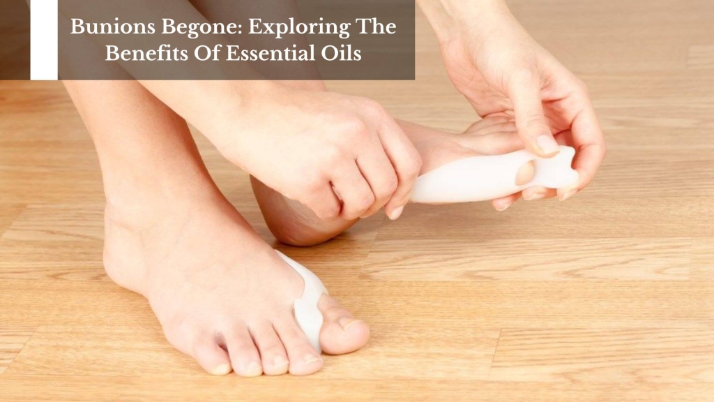 Bunions Begone: Exploring The Benefits Of Essential Oils - Moksha Lifestyle Products